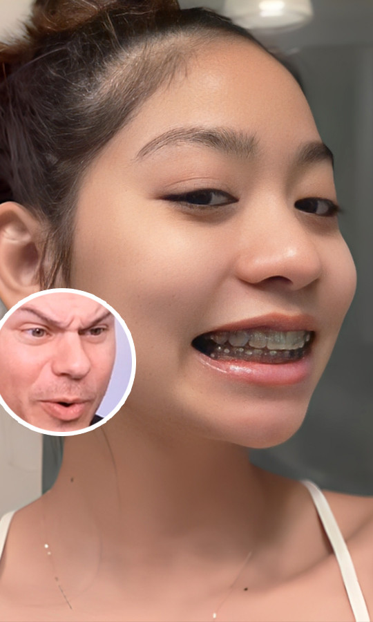 braces | Search Snapchat Creators, Filters and Lenses